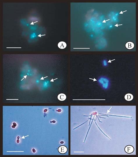 A C Dapi Staining Of Pfa Fixed Cells Arrows Attached To Mineral Download Scientific Diagram