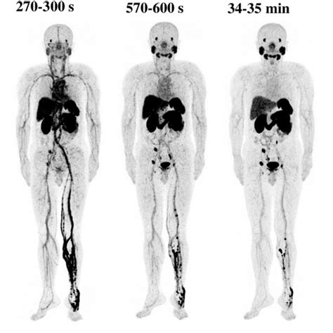 Maximum Intensity Projection Of Selected Dynamic Reconstructed Images