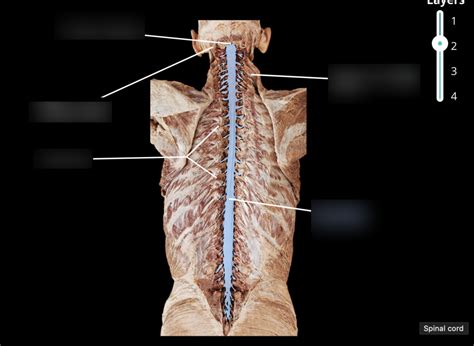 Bio 211 Lab Pal Human Cadaver Nervous System Slide 2 Diagram Quizlet