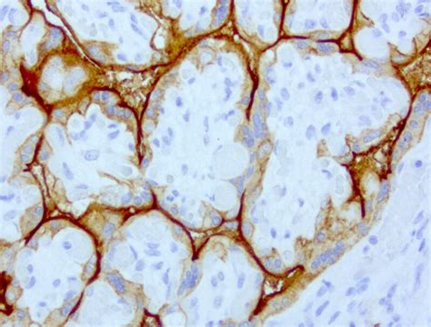 Egfr Antibody Um500070