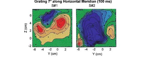 A Grating Stimulus Presented To The Same Position In The Visual Field