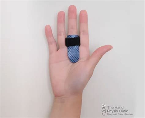 Trigger Finger Treatment Sydney Hand Therapy Clinic