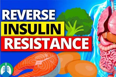 The Connection Between Insulin Resistance And Type 2 Diabetes