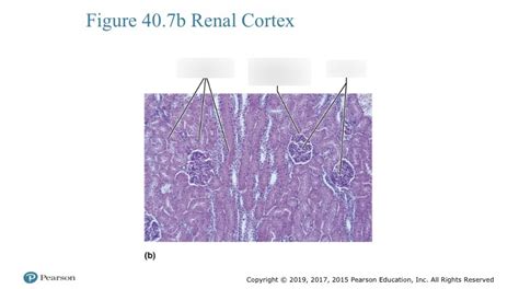 Figure 407b Renal Cortex Diagram Quizlet