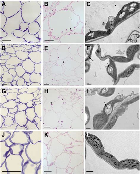 Figure 1 From Starch Granule Initiation In Arabidopsis Requires The Presence Of Either Class Iv