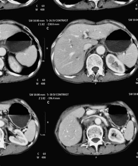 Private CT Scan Without Referral Near You Scan Com UK