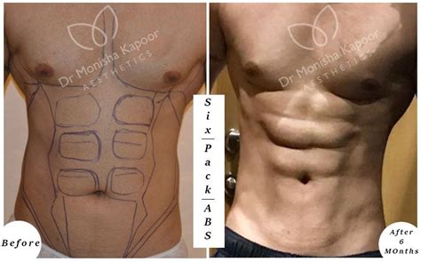 Pin On Six Pack Abs