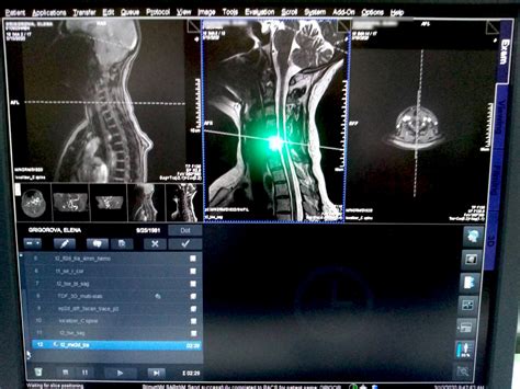 Д р Георги Стоилов Образна диагностика Пловдив Супердок