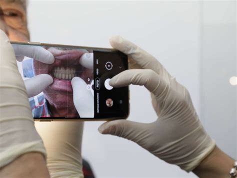 Clínicas Javier Cabrera ofrece implantes dentales 6 horas