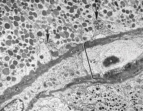 Electron Micrograph Showing The Two Basement Membrancs Of The Vascular