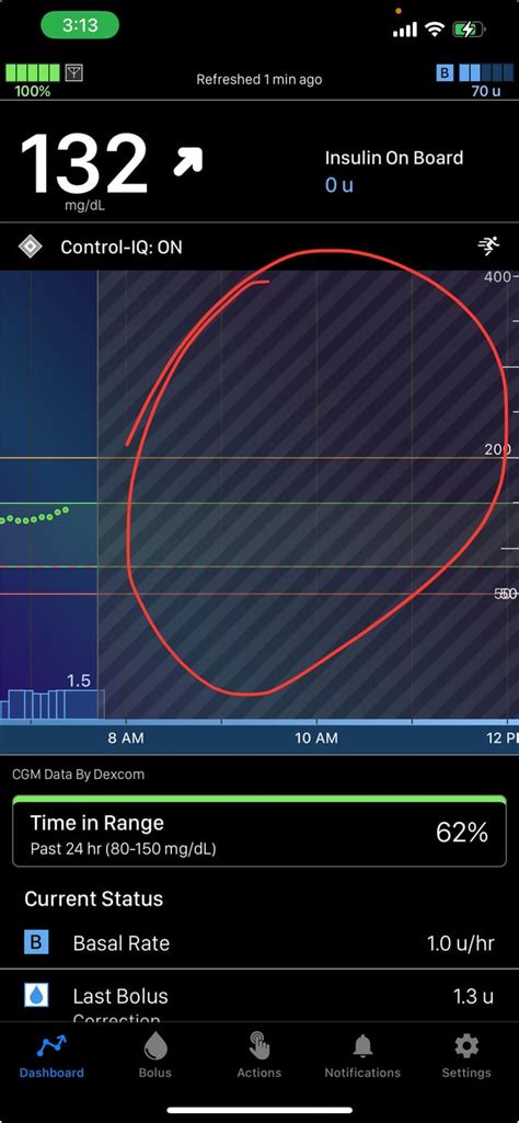Can Someone Tell Me Why My Graph Bg Isnt Showing On Mobi App R Tandemdiabetes