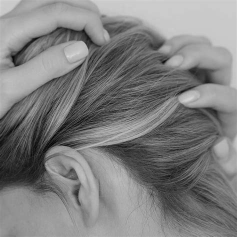 Dandruff Treatment Le Pure