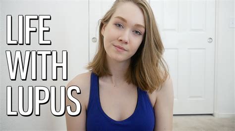 MY LIFE WITH LUPUS YouTube