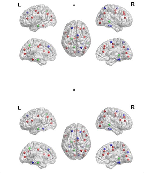 Regions With The Highest Network Measures For Planning Brain Network Download Scientific