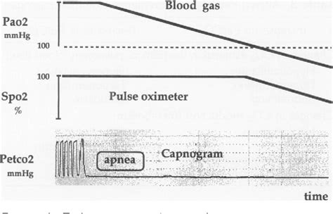 Figure 1 From Clinical Perspectives On Capnography During Sedation And General Anesthesia In