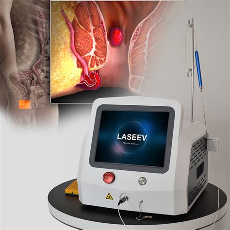 1470nm Surgical Laser Hemorrhoids Anal Fistula Proctology Laser Device