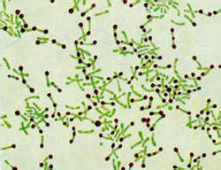 Albert Stain Principle Procedure And Results Microbe Online
