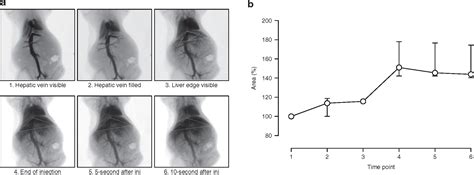 Hemodynamics Of A Hydrodynamic Injection Molecular Therapy Methods And Clinical Development