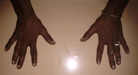 People With Long Fingers
