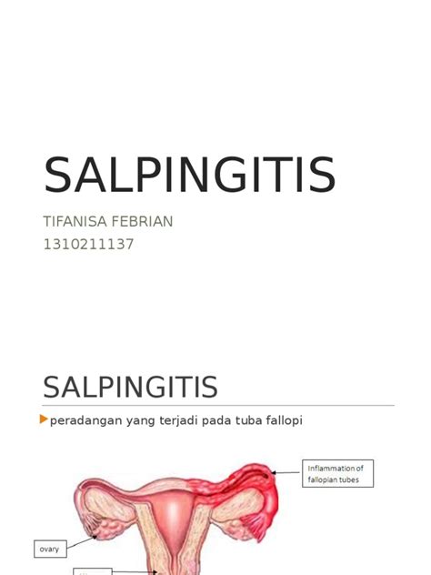 Salpingitis Sexual Health Medical Specialties