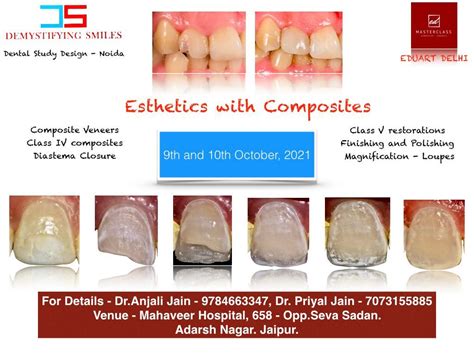 Dr Priyal Jain On Linkedin Dentist Dental Dentistry Dentalimplants Oralhealth Hospital
