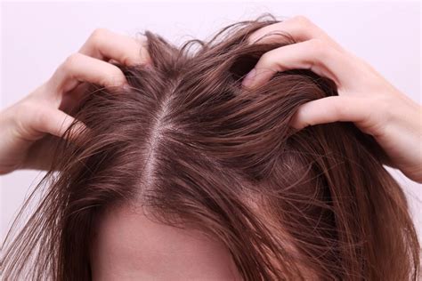 Yeast Infection On Scalp Causes Symptoms And Treatment