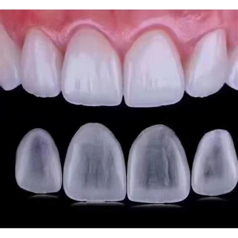 【dental Patches】【去牙黄，烟渍，茶渍】全瓷贴面牙齿贴片美牙蓝瓷铸瓷灵犀瓷玻璃瓷琥珀瓷义获嘉登士柏 Shopee Malaysia