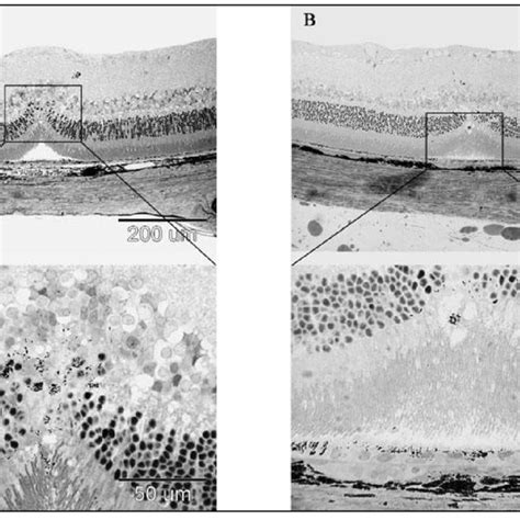 Light Micrographs Of Rat Retina 20 A And 60 B Days After Exposure