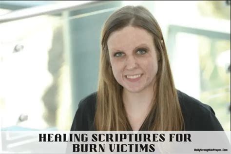 20 Healing Scriptures For Burn Victims To Pray Daily With Commentary
