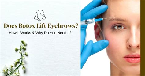 Does Botox Lift Eyebrows How It Works And Why Do You Need It Apprize
