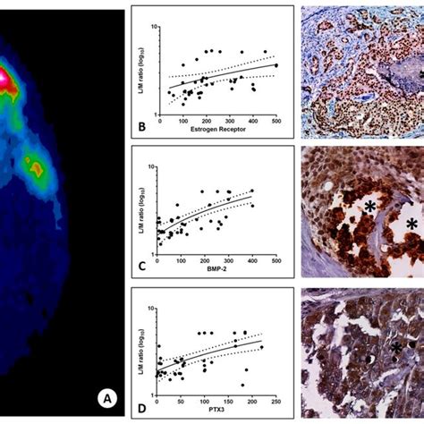 Association Between ⁹⁹mtc Tc Sestamibi Uptake And The Expression Of