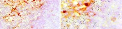 Immunohistochemistry Ihc Creative Diagnostics