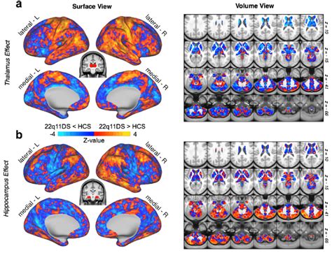 Threshold Free Seed Based Connectivity Maps Threshold Free Group Download Scientific Diagram