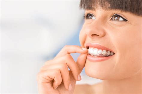 4 Benefits Of Invisalign Over Traditional Braces
