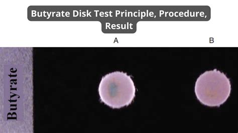 Nitrate Reduction Test Procedure Principle Result Biology Notes Online