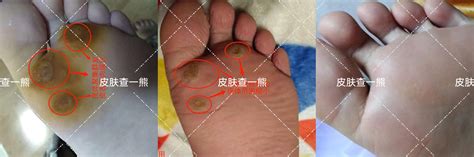 一篇文章了解【细菌、真菌与病毒】 知乎
