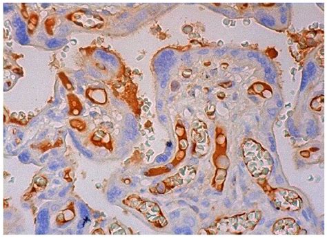 Anti C9 Antibody E 3 Scbt Santa Cruz Biotechnology