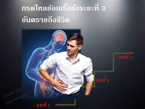 📌กรดไหลย้อนมี 3 ระยะ 📌 ระยะที่ 1 กระเพาะอักเสบ แสบกระเพาะ จุกเสียด 📌