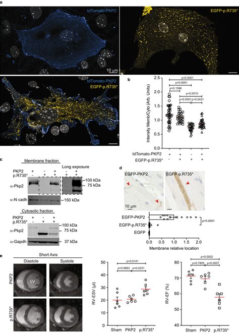 Pkp2 C Terminal Deletion Modifies Its Subcellular Localization And Download Scientific Diagram