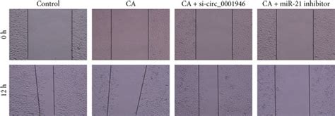 Calycosin Regulates Colony Formation Invasion Migration And Emt