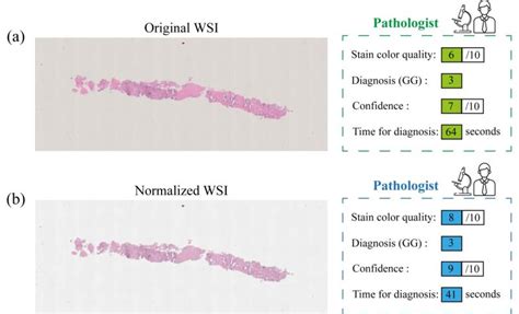 Impact Of Stain Normalization On Pathologist Assessment Of Prostate