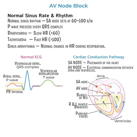 Clinical Pathology Glossary Arrhythmias Av Node Block Ditki