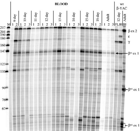 Developmental Profile Of ␤ Like Globin Gene Expression In ␤ M 5 Ј ε