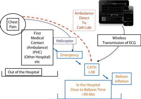 Implementation Plan For The Nationwide Primary Pci Program In Qatar To Download Scientific