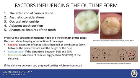 Blacks Cavity Classification For Pit And Fissure Caries Pdf