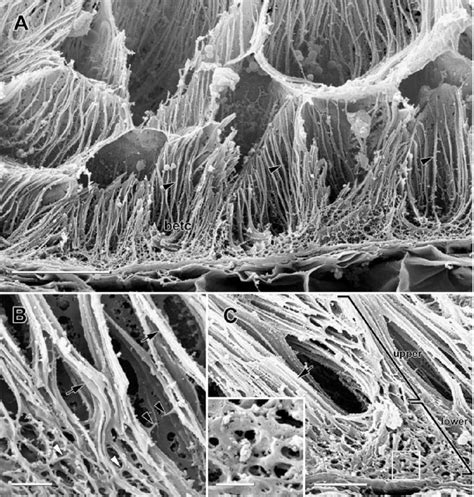 A C Flangelike Wall Ingrowths In Basal Endosperm Cells Of