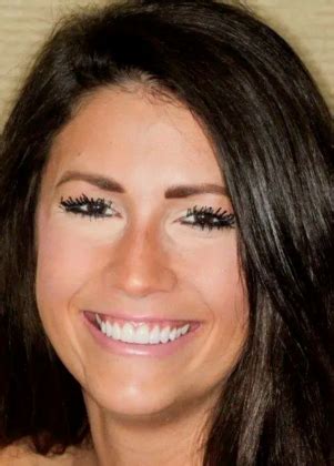 Case 18 Smile Makeover Veneers Before And After Gallery