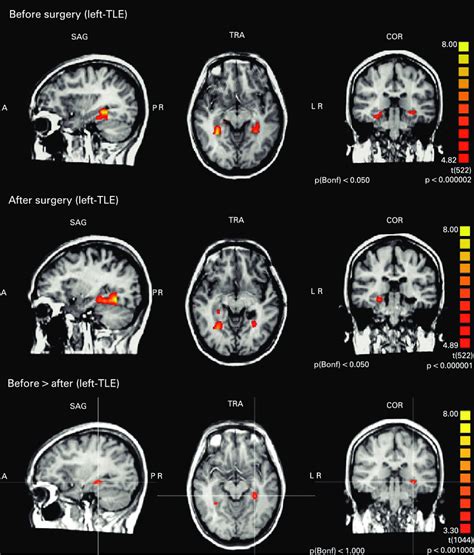 Group Activation Patterns During Complex Scene Encoding Memory Task