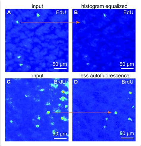 image preprocessing a b histogram equalization c d suppressing