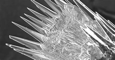 Electron Microscope Photos Pretty Awesome Album On Imgur